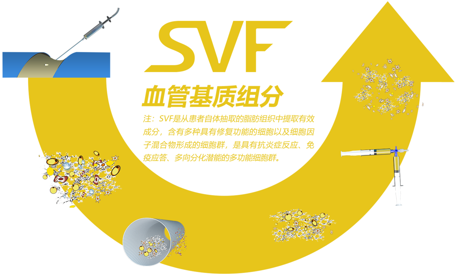 嘉思特医疗器材（天津）股份有限公司